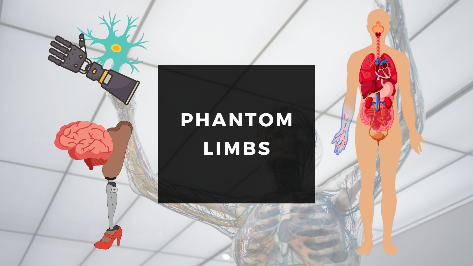 Feeling a Missing Limb: Phantom Limb Syndrome - OkButWhy